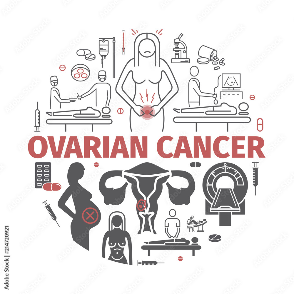 Ovarian Cancer. Symptoms, Causes, Treatment. Line icons set. Vector ...