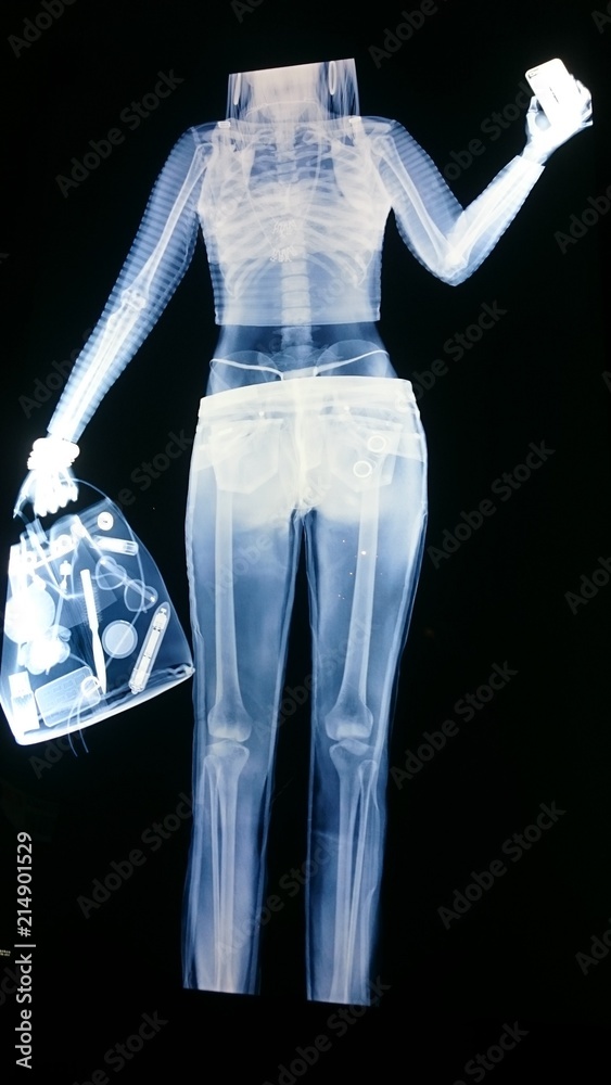 Female body x-ray with a handbag Stock Photo | Adobe Stock