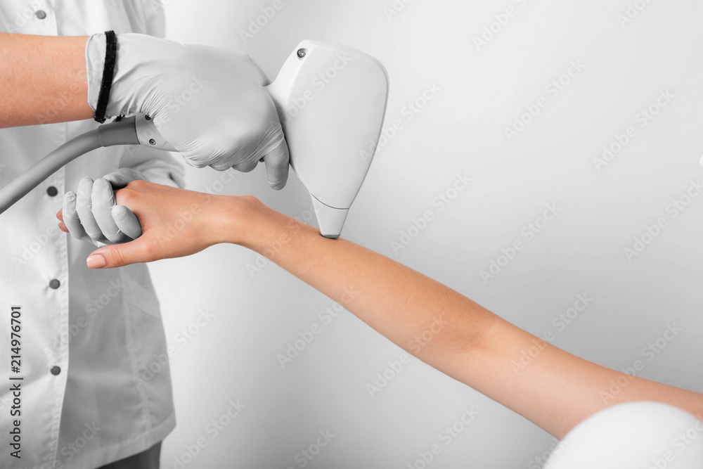 beautician removes hair on beautiful female hands using a laser. hair ...