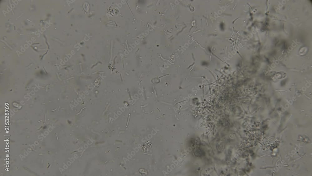 a drop of dirty water with bacteria: spirochaetes, rod-shaped bacteria ...