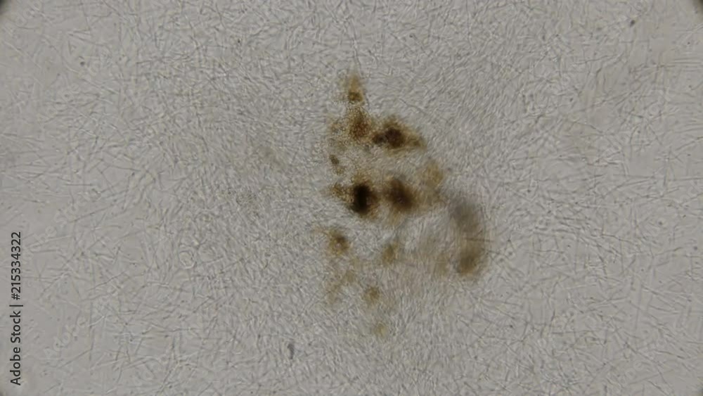 colony of spirochete, rod-shaped bacteria and other bacteria living in ...