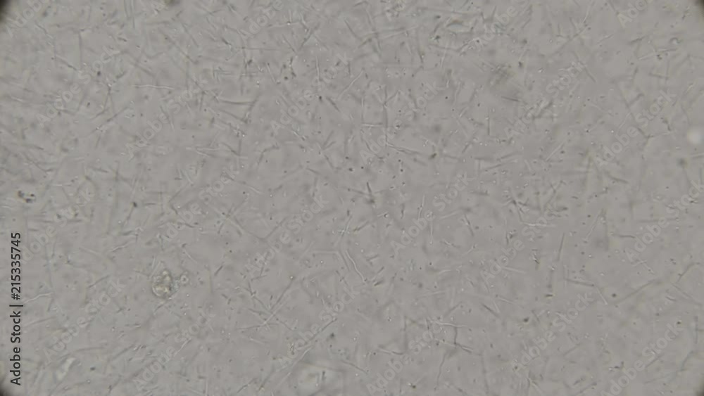 colony of spirochete, rod-shaped bacteria and other bacteria living in ...