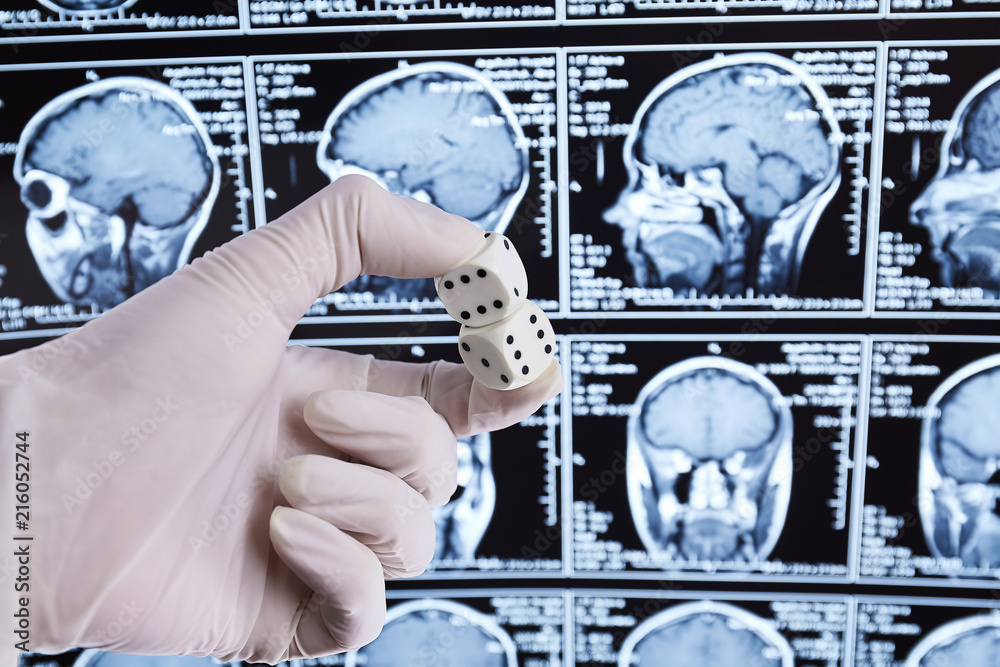 Magnetic resonance scan of the brain. MRI. Dice in hand Stock Photo ...