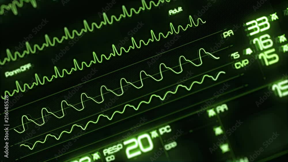 Multi-parameter patient monitor screen / Medical green screen interface ...