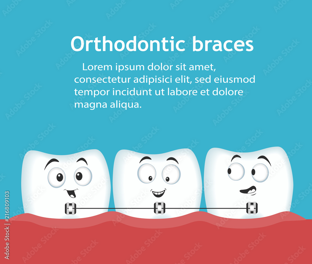 Orthodontic braces banner with teeth characters Stock Vector | Adobe Stock