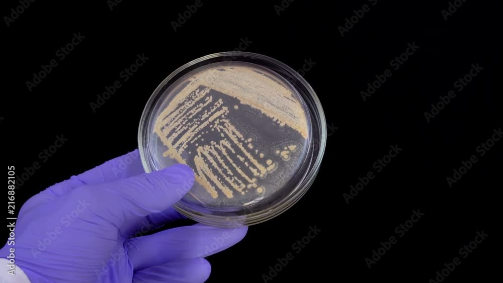 A microbiologist examines bacterial colonies on a petri dish. Visual ...