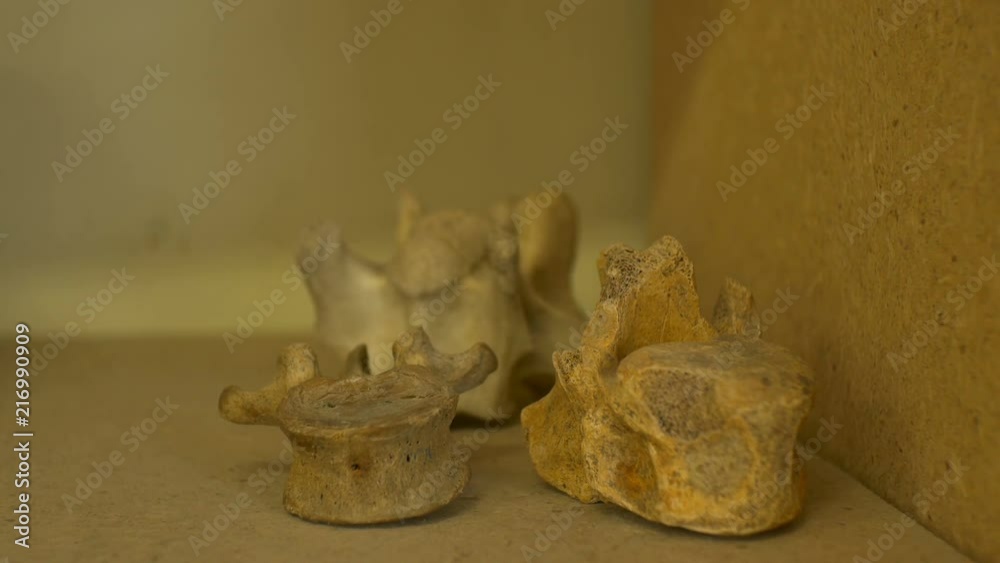 Old human body spinal cord bones exposed on an anatomy laboratory ...