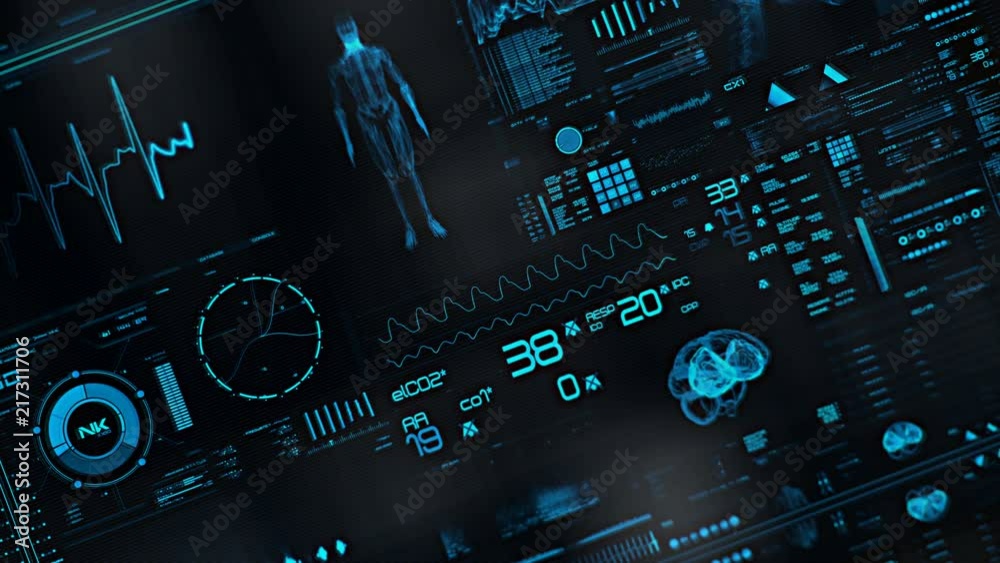 Futuristic patient monitor screen / Medical blue screen interface ...