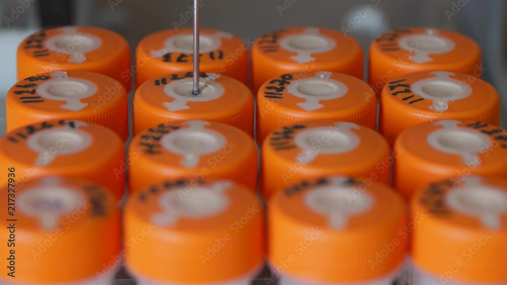 Close-up in the medical laboratory automated process of cancer cell ...