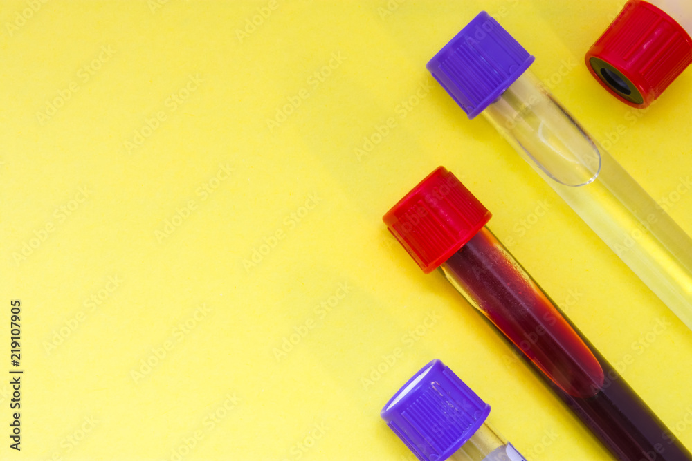 Medical or scientific laboratory tubes with blood are on yellow uniform ...