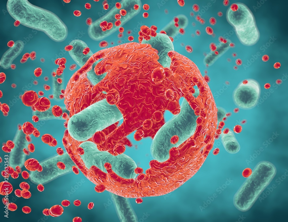 Bacterial infection disease concept. Bacteria spreading and destroying ...