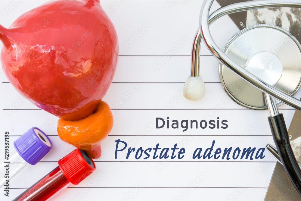 Diagnosis of Prostate Adenoma. Medical concept picture of diagnosis ...