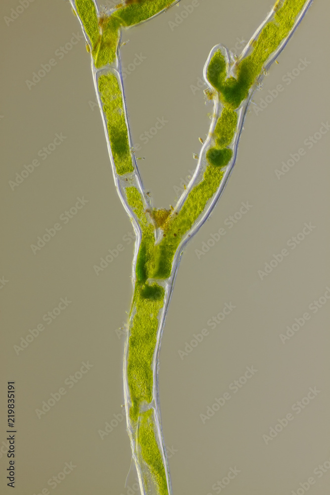 Cladophora Algae Under Microscope