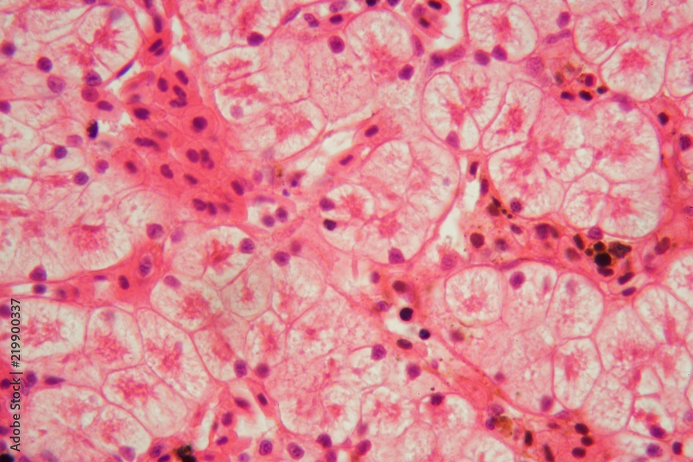 Microscope photo of a section through a frog liver. Stock Photo | Adobe ...