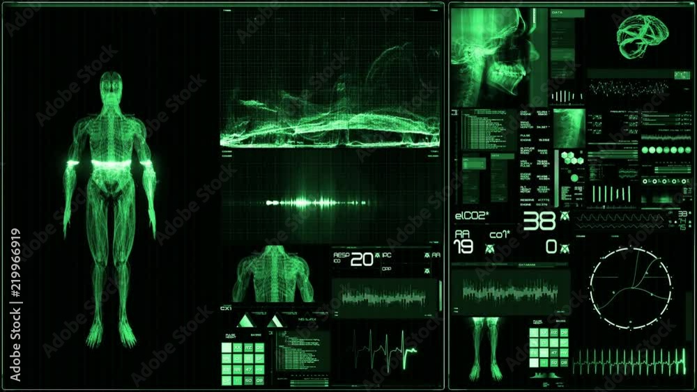 Green futuristic patient monitor screen in perspective / Medical screen ...