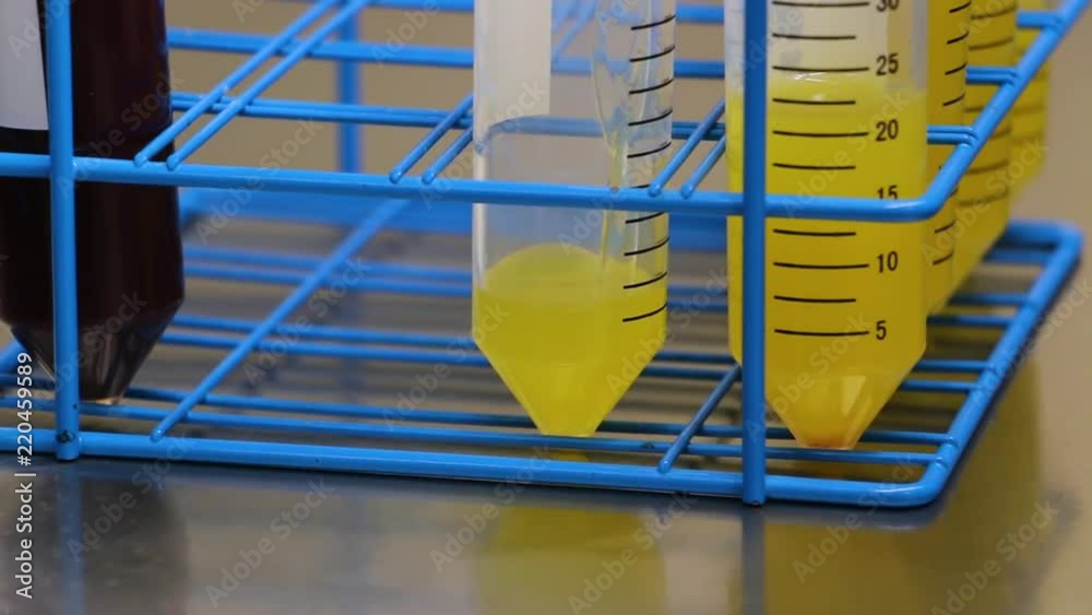 Vídeo do Stock: Final Separation Extracting Plasma with a Siphon and ...