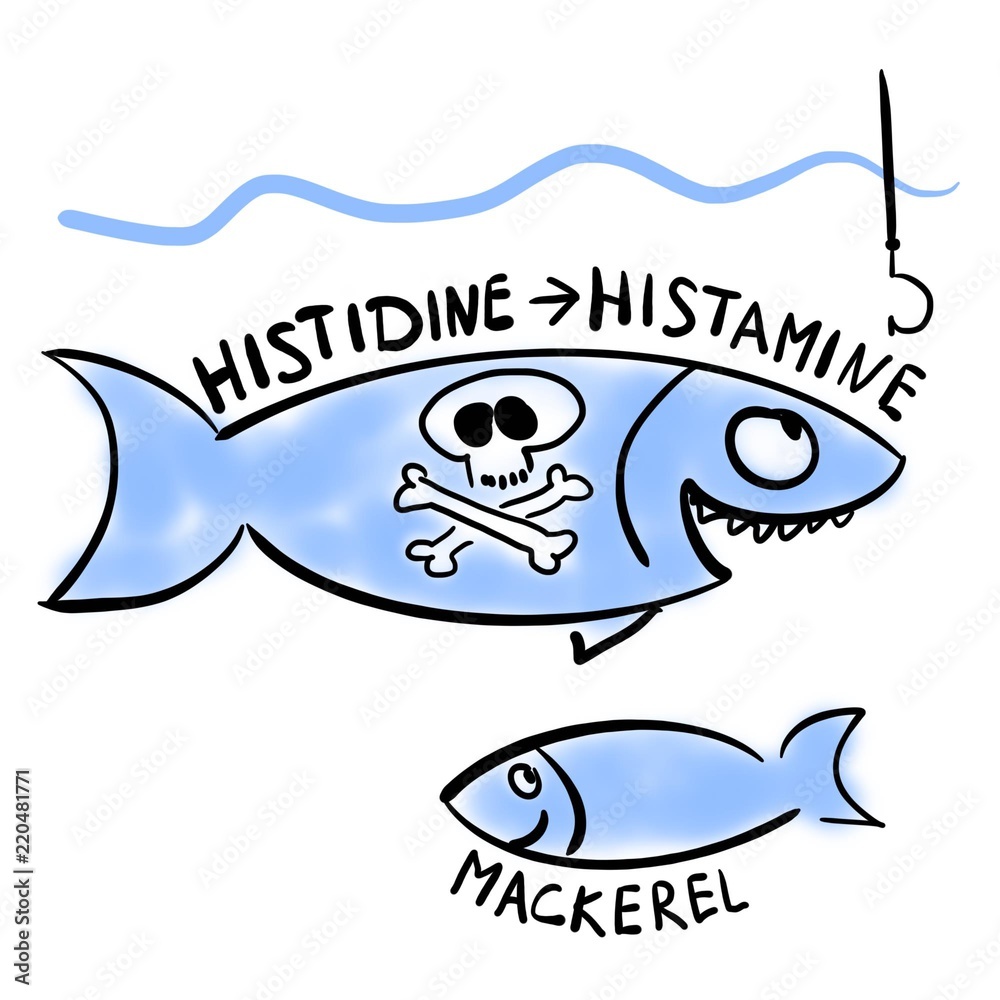 Histamine fish poisoning Stock Illustration | Adobe Stock