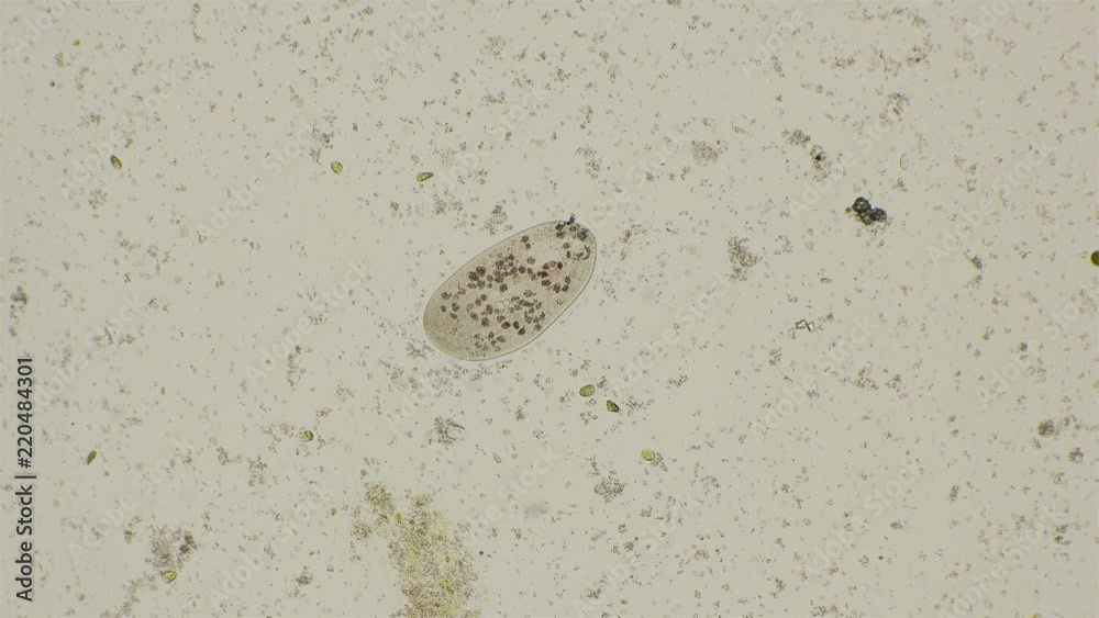 Infusoria feeding on bacteria Archea acquired a pink hue, under a ...