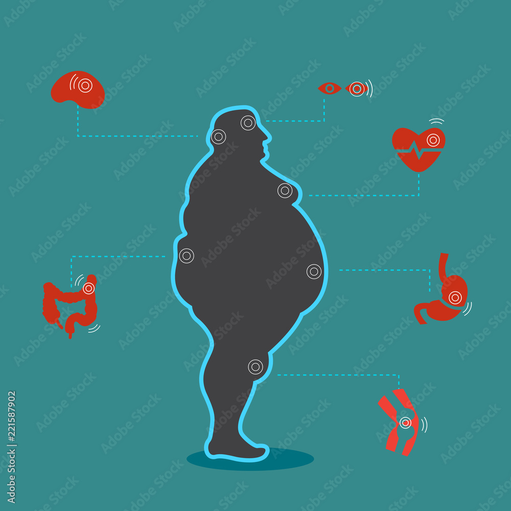 infographic Obesity illustration Poster template The effect of obesity ...