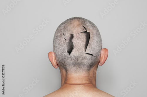 Cracked Human Head