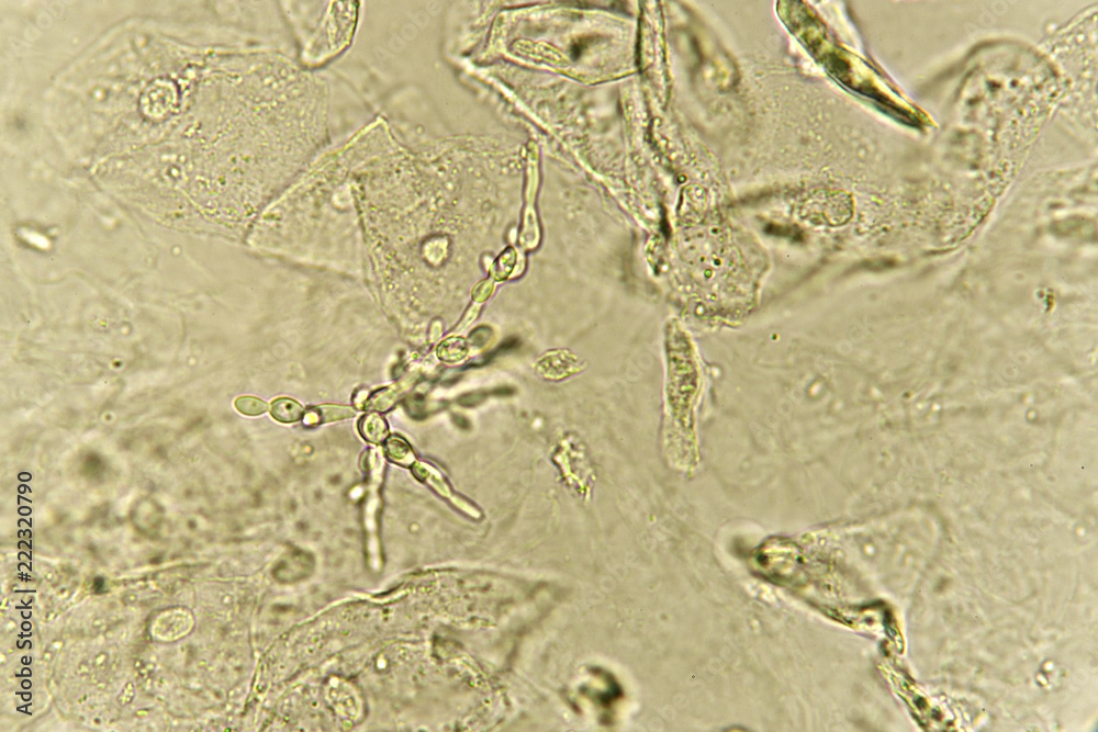 Pseudohyphae