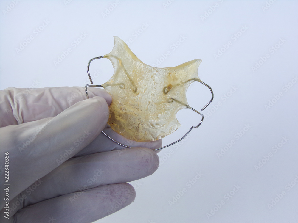 Dentist showing the removable orthodontic appliance. Mobile orthodontic ...