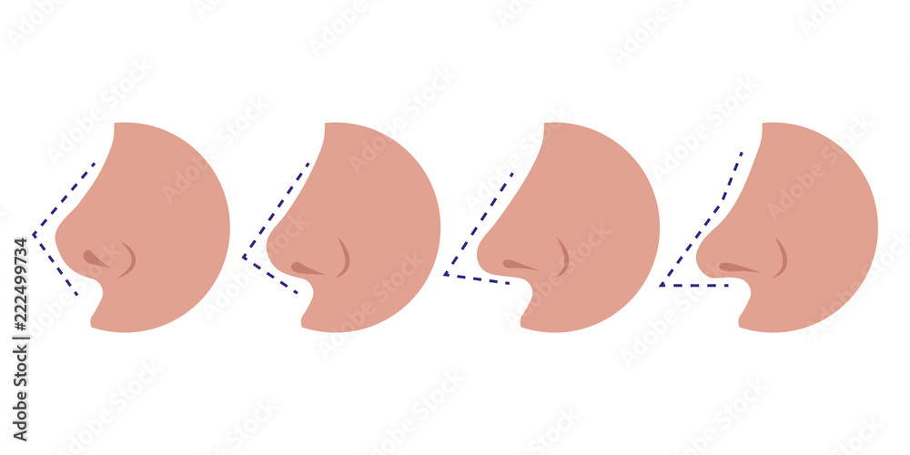Vector illustration different types female noses Stock Vector | Adobe Stock