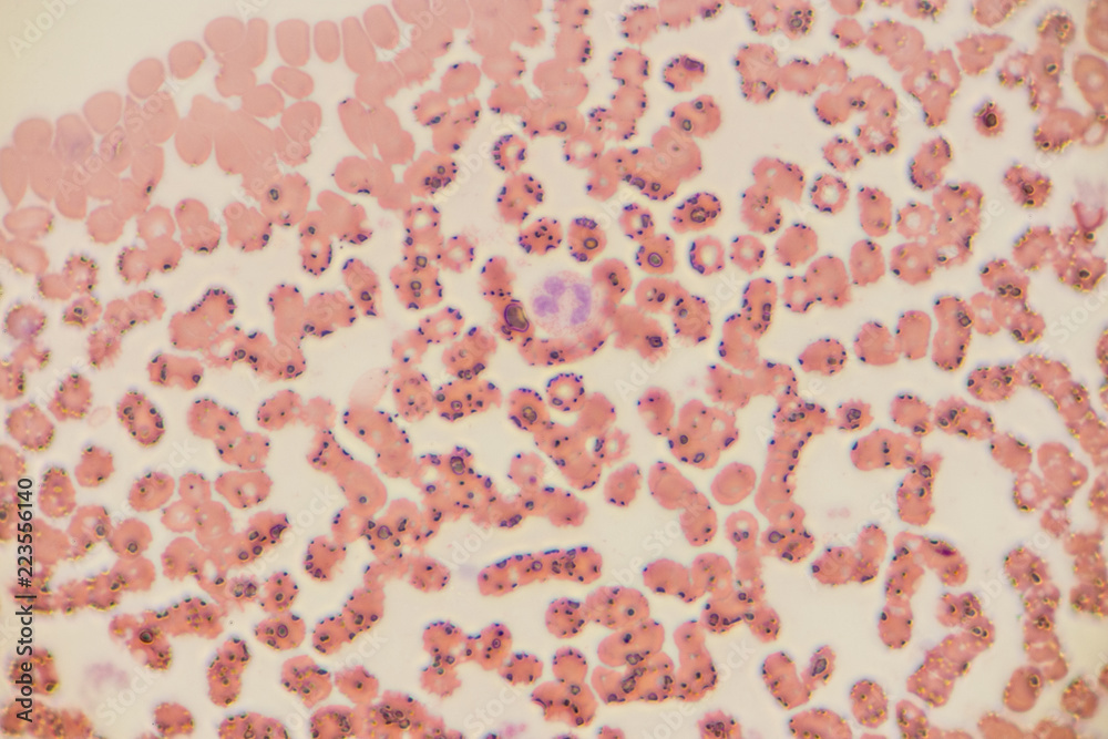 Study of white blood cells are the cells of the immune system under the ...