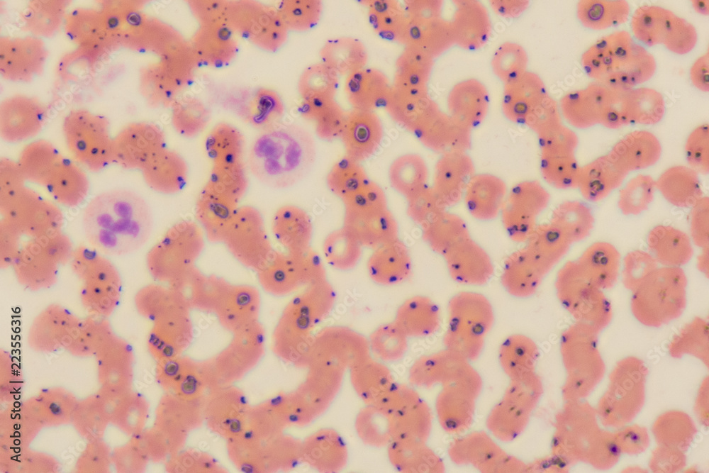 Study of white blood cells are the cells of the immune system under the ...