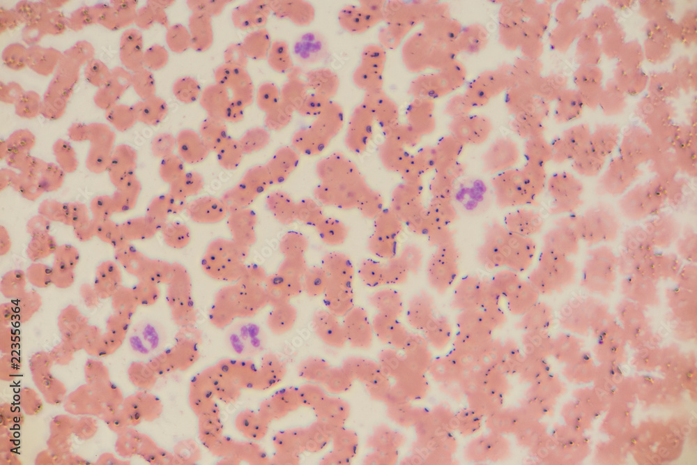 Study of white blood cells are the cells of the immune system under the ...