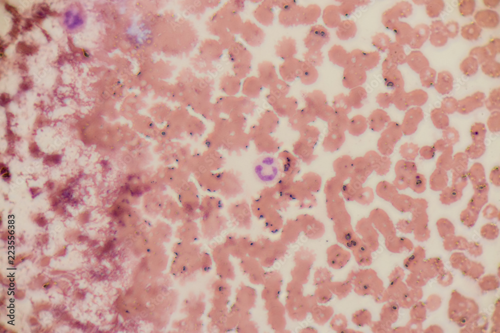 Study of white blood cells are the cells of the immune system under the ...