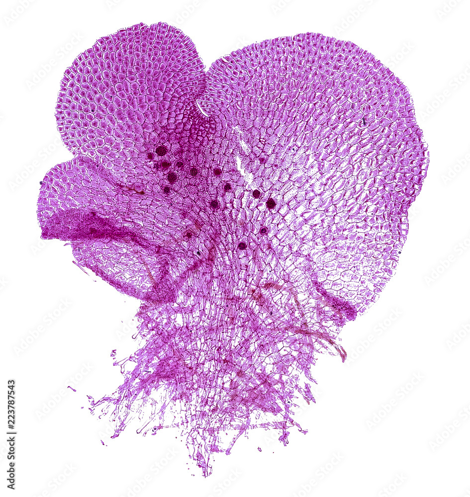 fern prothallium - cross section cut under the microscope – microscopic ...