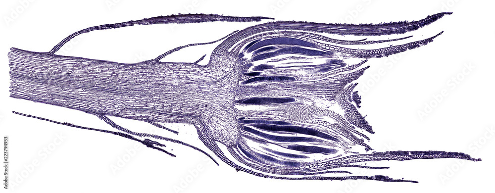 moss antheridium - cross section cut under the microscope – microscopic ...