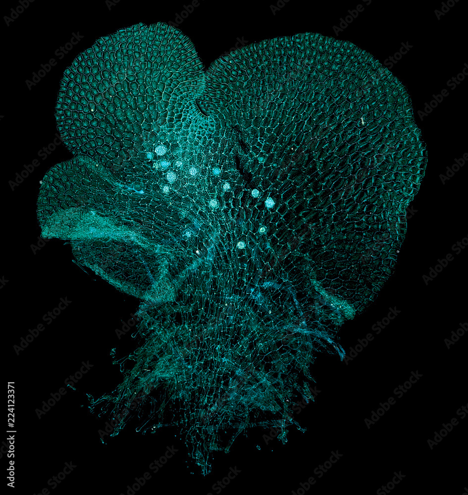Fotka „fern prothallium - cross section cut under the microscope ...
