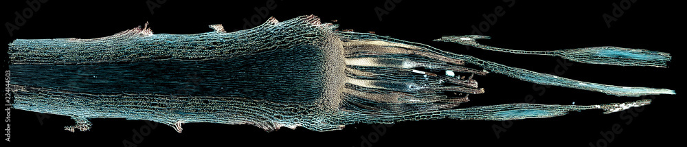 moss archegonium - cross section cut under the microscope – microscopic ...