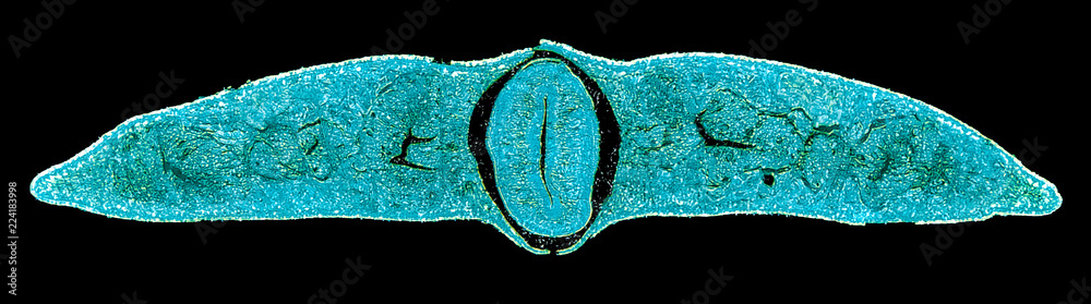 turbellaria - cross section cut under the microscope – microscopic view ...
