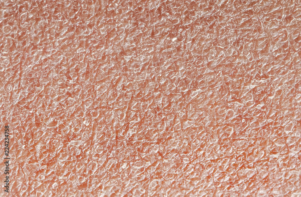 background texture of unhealthy human skin covered with deep wrinkles ...