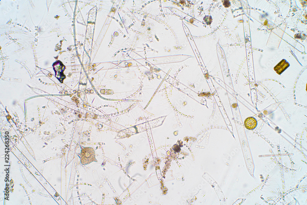 Marine aquatic plankton under microscope view Stock Photo | Adobe Stock
