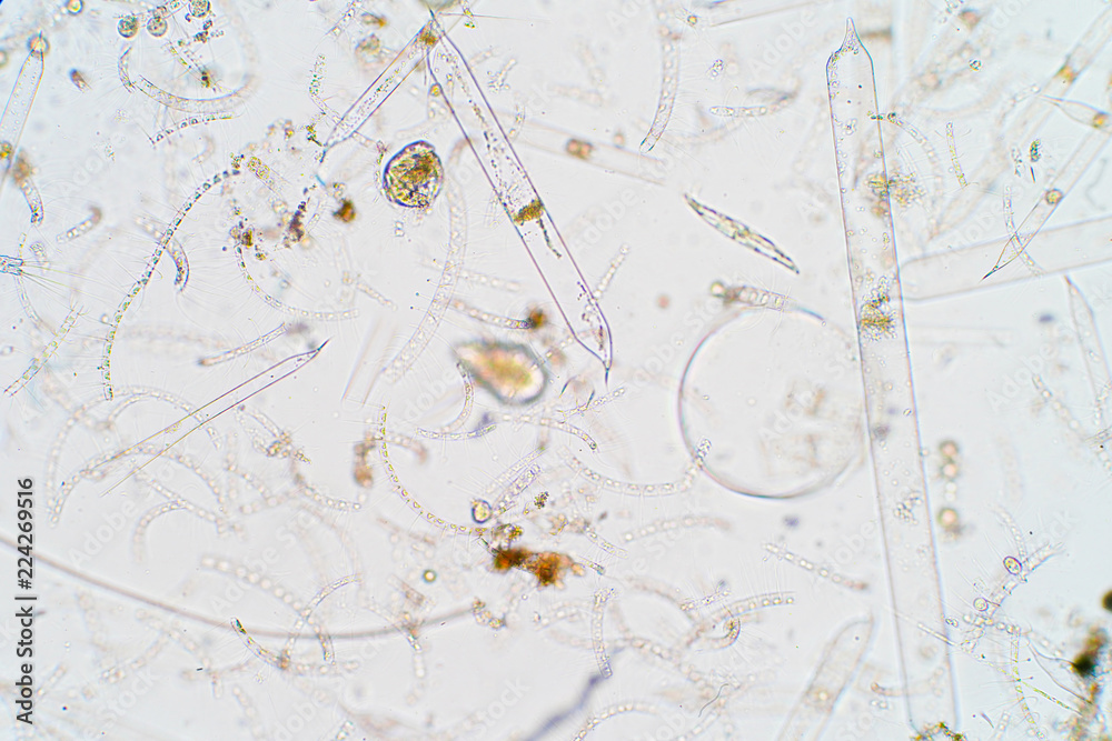Marine aquatic plankton under microscope view Stock Photo | Adobe Stock