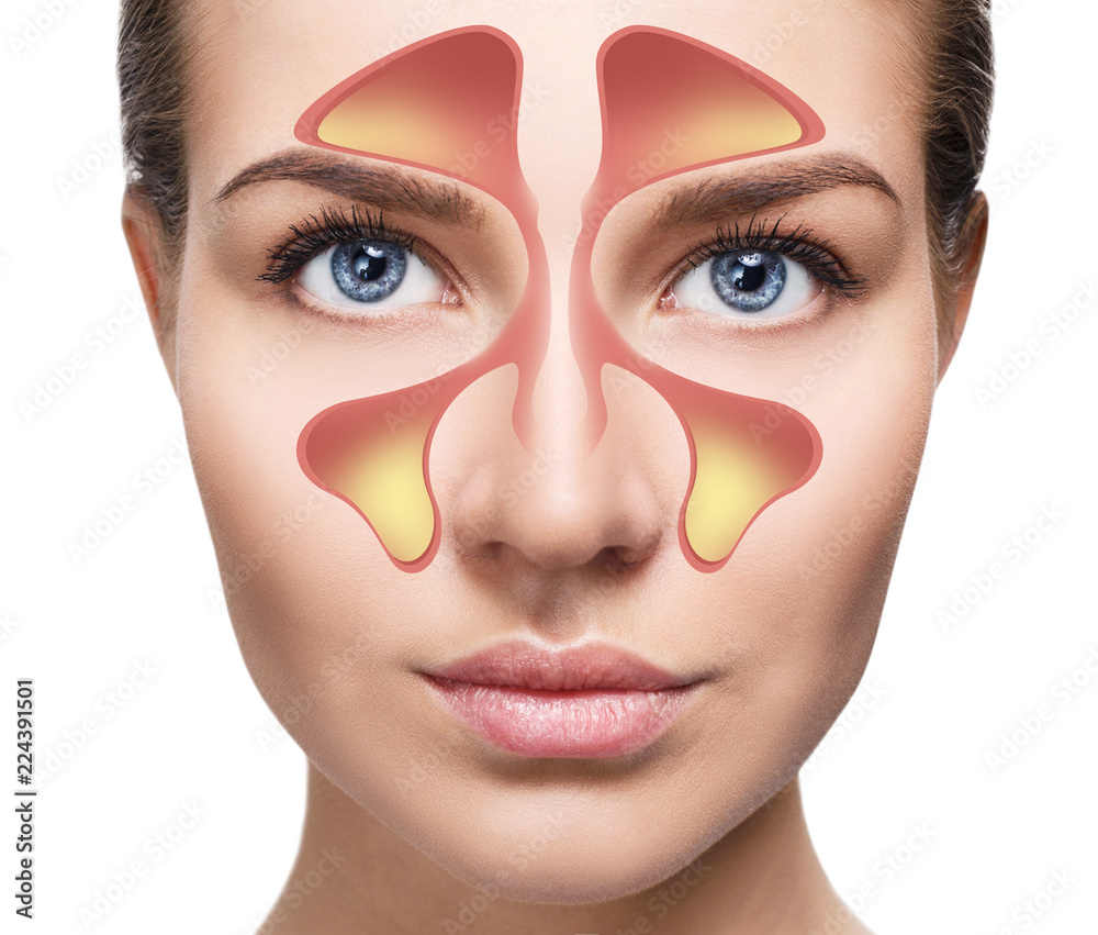 Female face shows nasal sinus with cold over white background. Stock ...