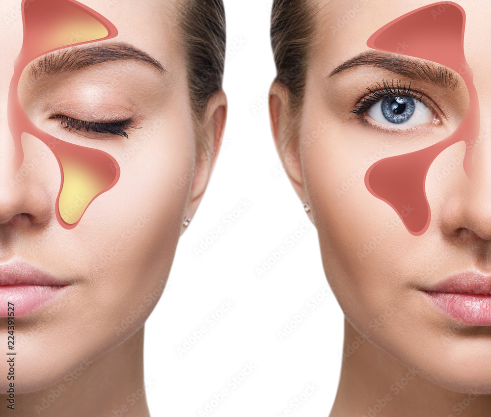 Female face shows nasal sinus with cold over white background. Stock ...