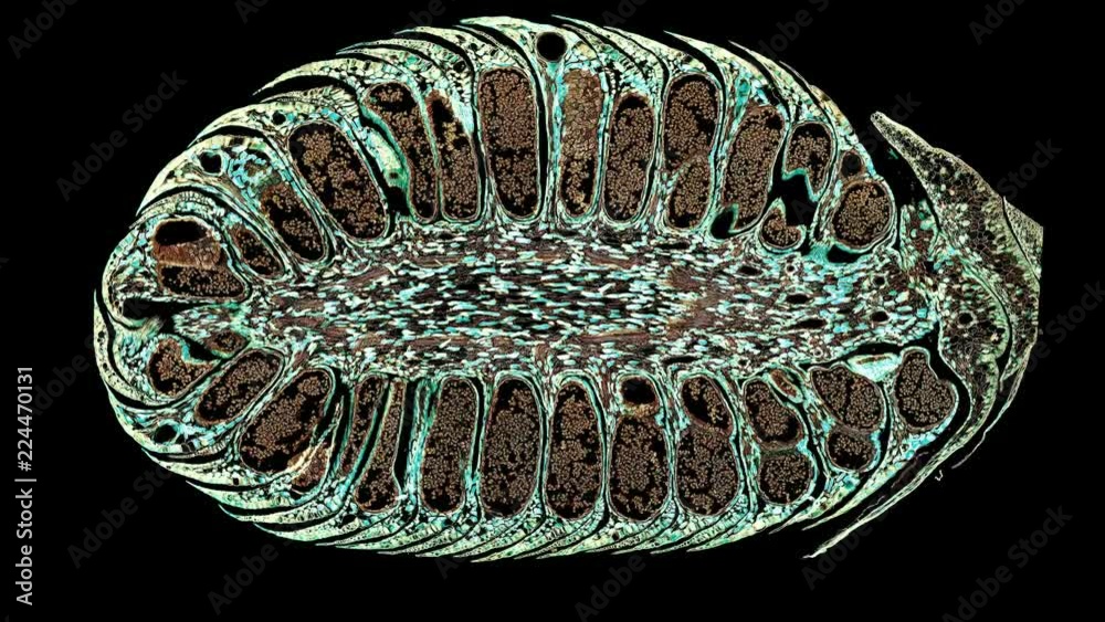 pine male cone - cross section cut under the microscope – microscopic ...