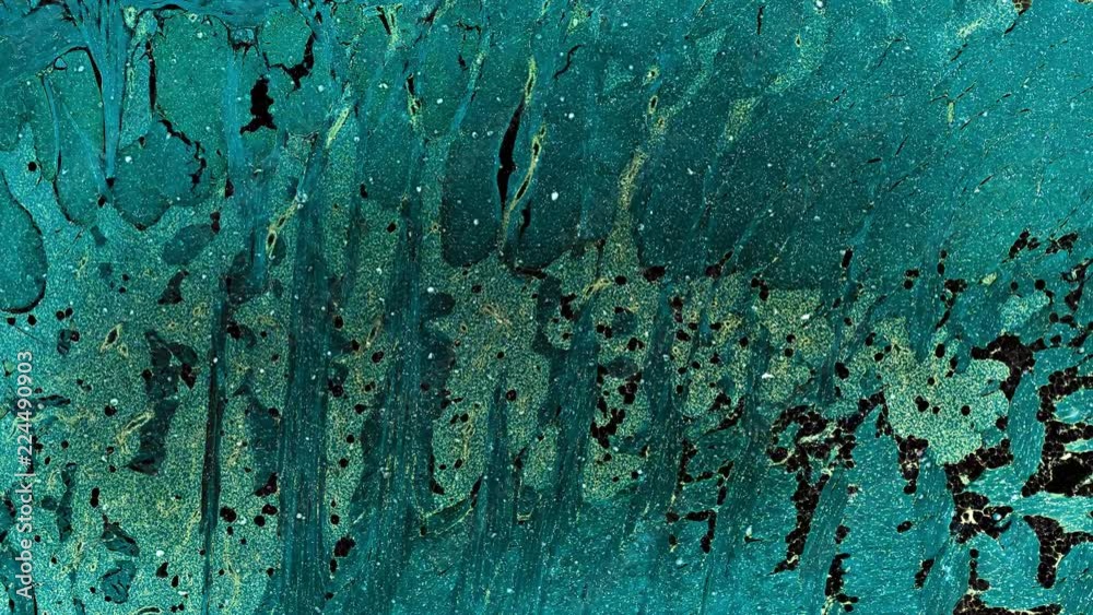 taste bud - cross section cut under the microscope – microscopic view ...