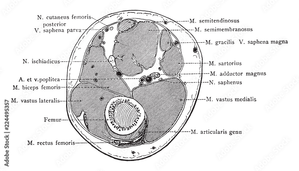 Cross Section Through Thigh Five Inches Above Knee Joint, vintage ...