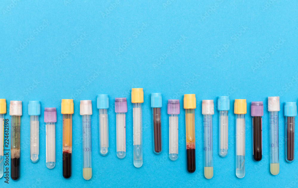 Blood samples in a rack. close-up medicine test tubes blood for blue ...
