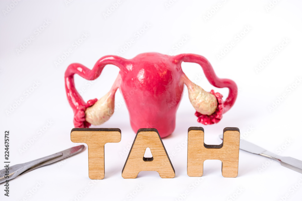 Anatomical shape of uterus with ovaries is at slightly blurred ...