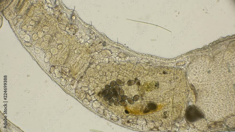 the stomach of an intestinal worm oligochaete of a rotifers rotted and ...