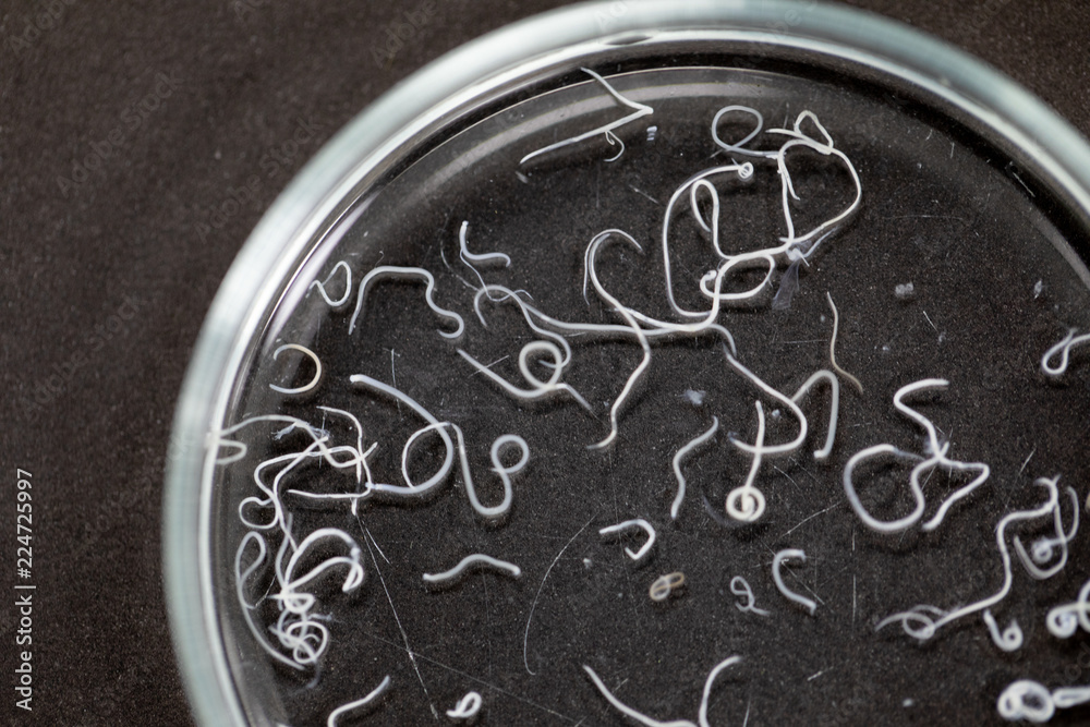 Ascariasis is a disease caused by the parasitic roundworm Ascaris ...