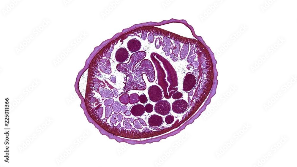 ascaris - cross section cut under the microscope – microscopic view of ...
