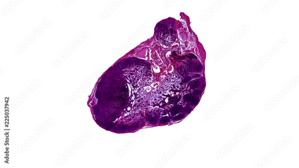 Vidéo Stock lymphonodus - cross section cut under the microscope ...